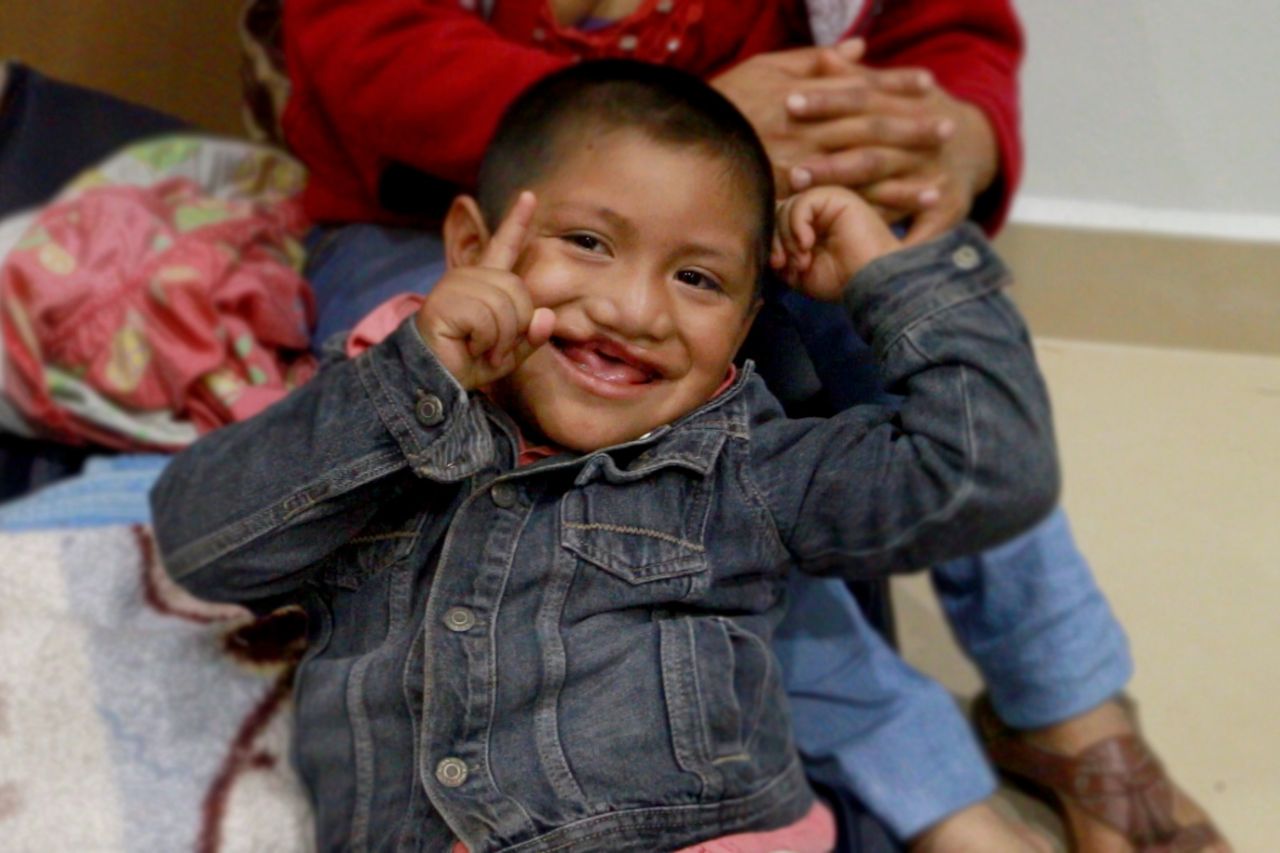 Fundación Gigante transforma vidas apoyando a niñez con labio y paladar ...